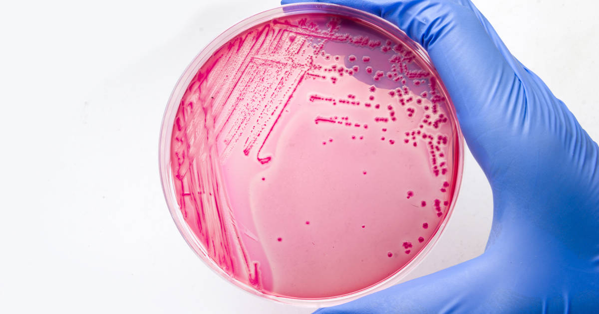 Coliform Bacteria in Water Test | CTS